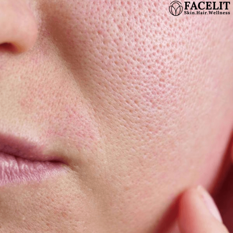 How to Fix Clogged Pores: Causes, Solutions & Skincare Tips